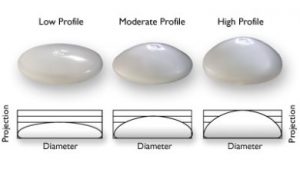 High Profile Breast Implants